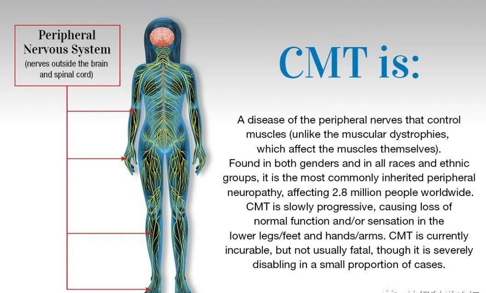 Int J Mol Sci：腓骨肌萎缩症（CMT）的临床分型与诊断要点汇总！-德医学院-助力医学教育发展！