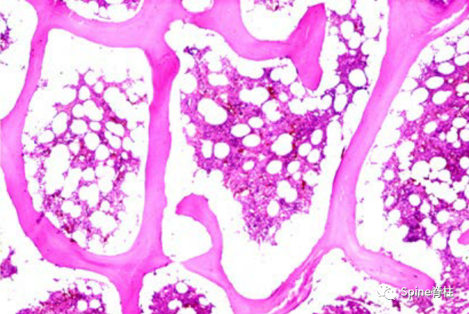 Modic改变的定义和临床分级-德医学院-助力医学教育发展！