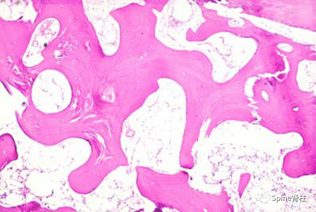 Modic改变的定义和临床分级-德医学院-助力医学教育发展！